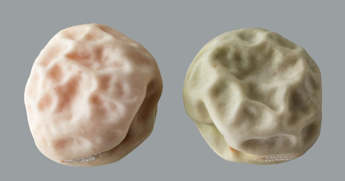 Cyst vs Tumor: Key Differences You Should Know